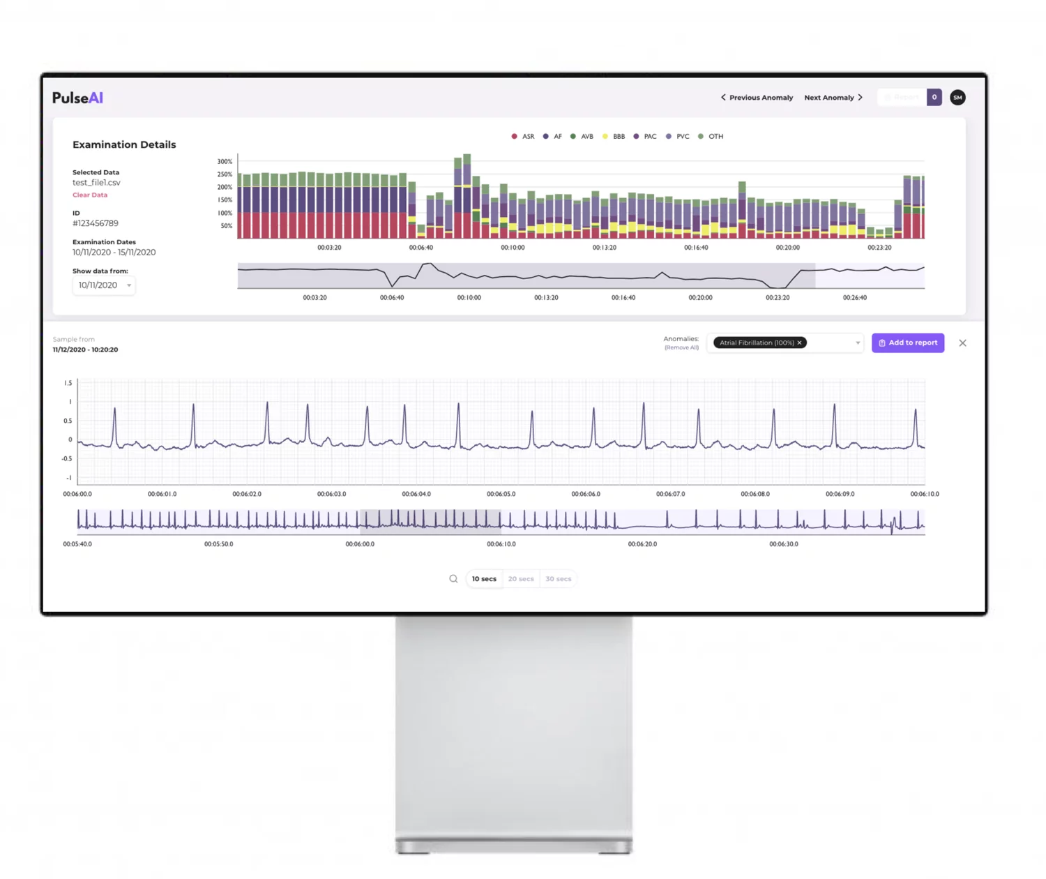 Pulse AI | Case Study | Med Tech | GCD